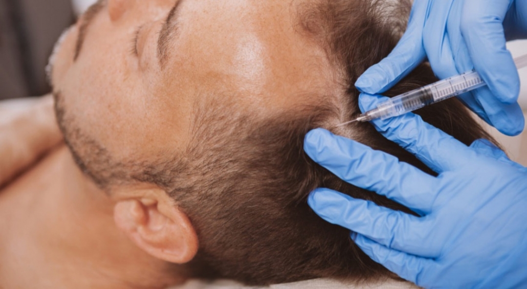 PRP Therapy – Emma Mac Beauty Salon